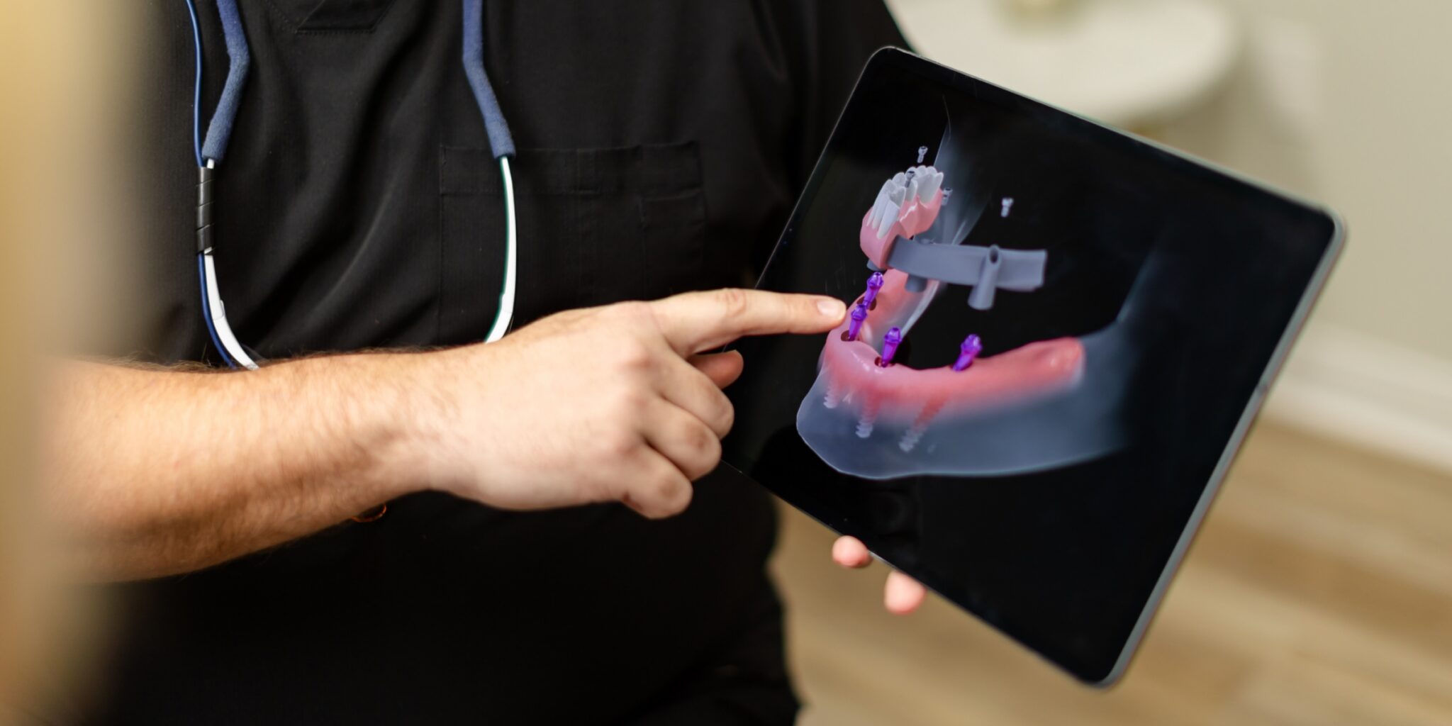 All on 4 and Full Mouth Dental Implants Front Royal